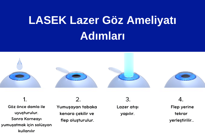 LASEK Lazer Göz Ameliyatı Hakkında - LASIK - No-Touch - PRK